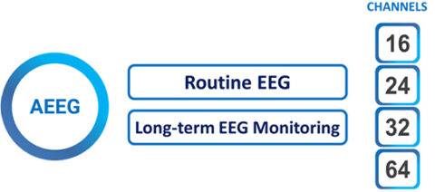 Portable EEG Device Singapore | AEEG Device Supplier | Ambulatory EEG ...